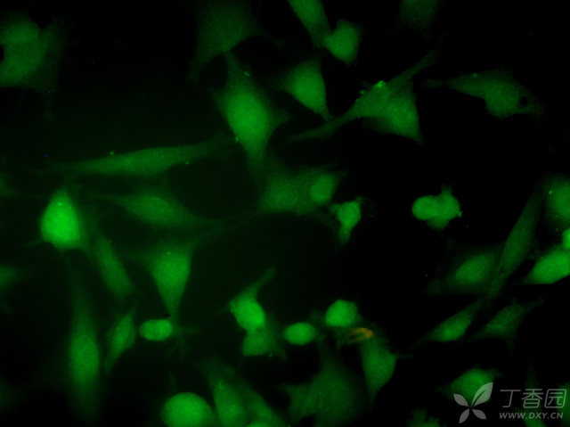 免疫荧光双标，大家帮我看看 - 免疫学讨论版 -丁香园论坛