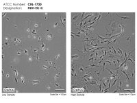 ATCC 细胞 NK-92 Natural Killer Cell Human (ATCC® CRL-2407™) _价格-厂家-供应商_北京中源合聚生物科技有限公司_丁香通