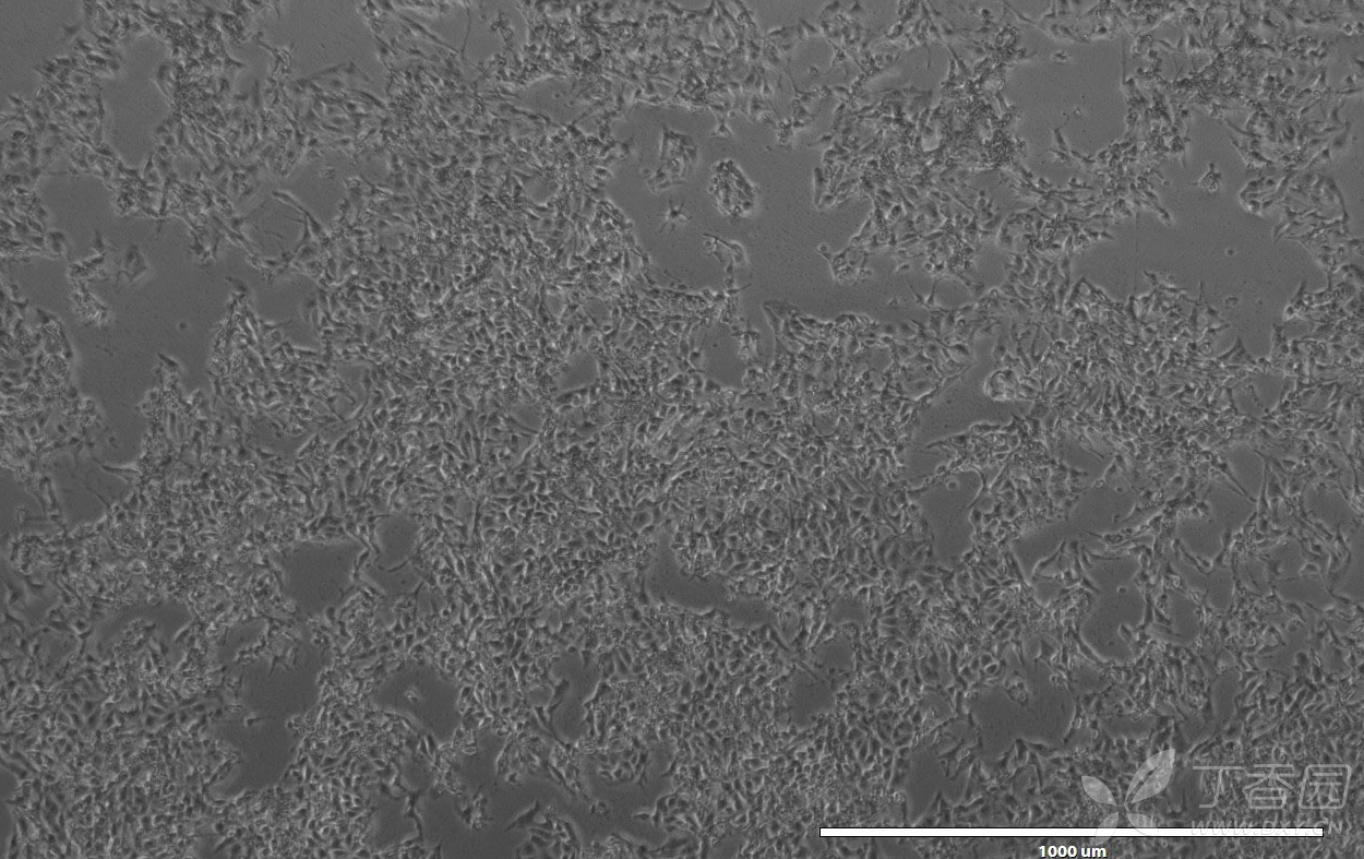 我的PK15和LLC-PK1细胞形态拉丝，请问是何问题？急求大神帮忙~~ - 细胞技术讨论版 -丁香园论坛