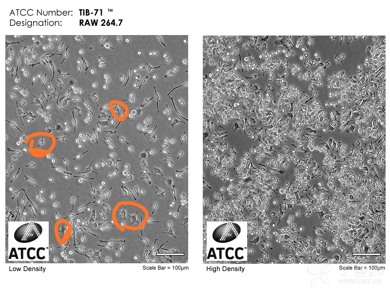 raw264.7细胞最佳状态长什么样子？ - 细胞技术讨论版 -丁香园论坛