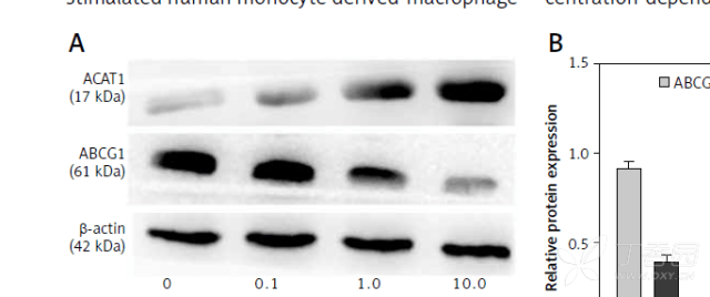 怎么知道蛋白质分子量？Western blot的内参怎么选择？ - 蛋白质和糖学 -丁香园论坛