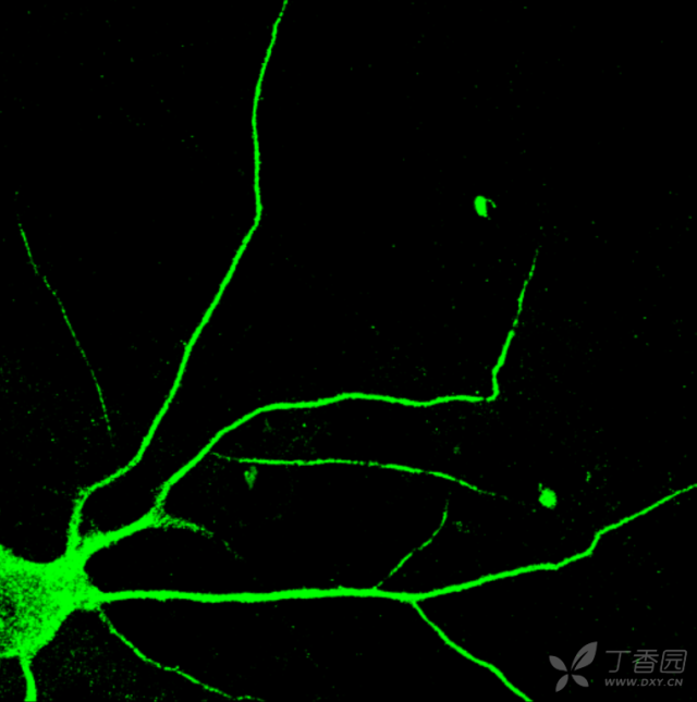 细胞免疫荧光用MAP2标记神经元后观察spine - 神经生物学讨论版 -丁香园论坛