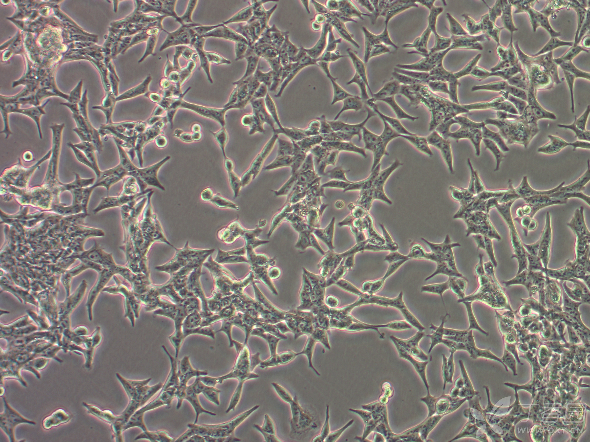 养得还不错的Lncap，大家有需要的可以交流哦 - 细胞技术讨论版 -丁香园论坛