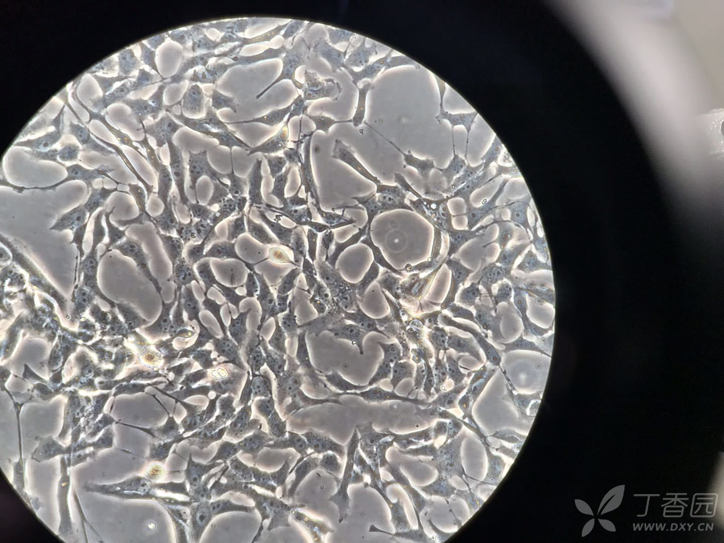 MC3T3-E1细胞一加矿化液就死？ 它和subclone 14 的区别是什么？ - 细胞技术讨论版 -丁香园论坛