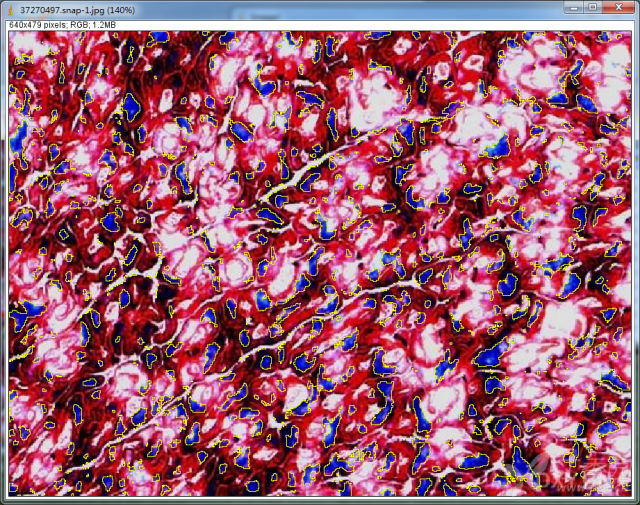 【求助】请问如何应用ImageJ分析Masson三色染色的图片 - 丁香园论坛
