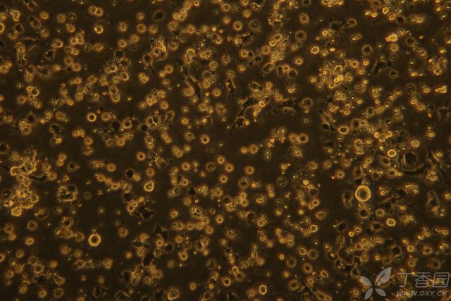 小鼠骨髓来源的树突状细胞（bmDC）的培养和鉴定——细胞碎片的来源？ - 细胞技术讨论版 -丁香园论坛