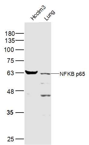 NFKB p65细胞核因子NFKBp65抗体价格_品牌:LMAI Bio-丁香通官网