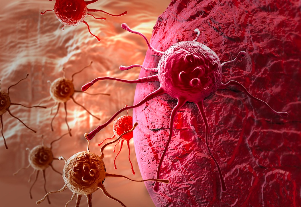 OS、PFS、DFS 有什么区别？一文搞懂 6 大肿瘤临床试验终点