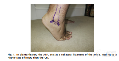 急性外踝不稳（一） - 康复医学讨论版 -丁香园论坛