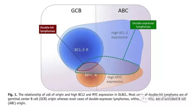 分子时代自体造血干细胞移植在弥漫大B细胞淋巴瘤非特指型治疗中的地位