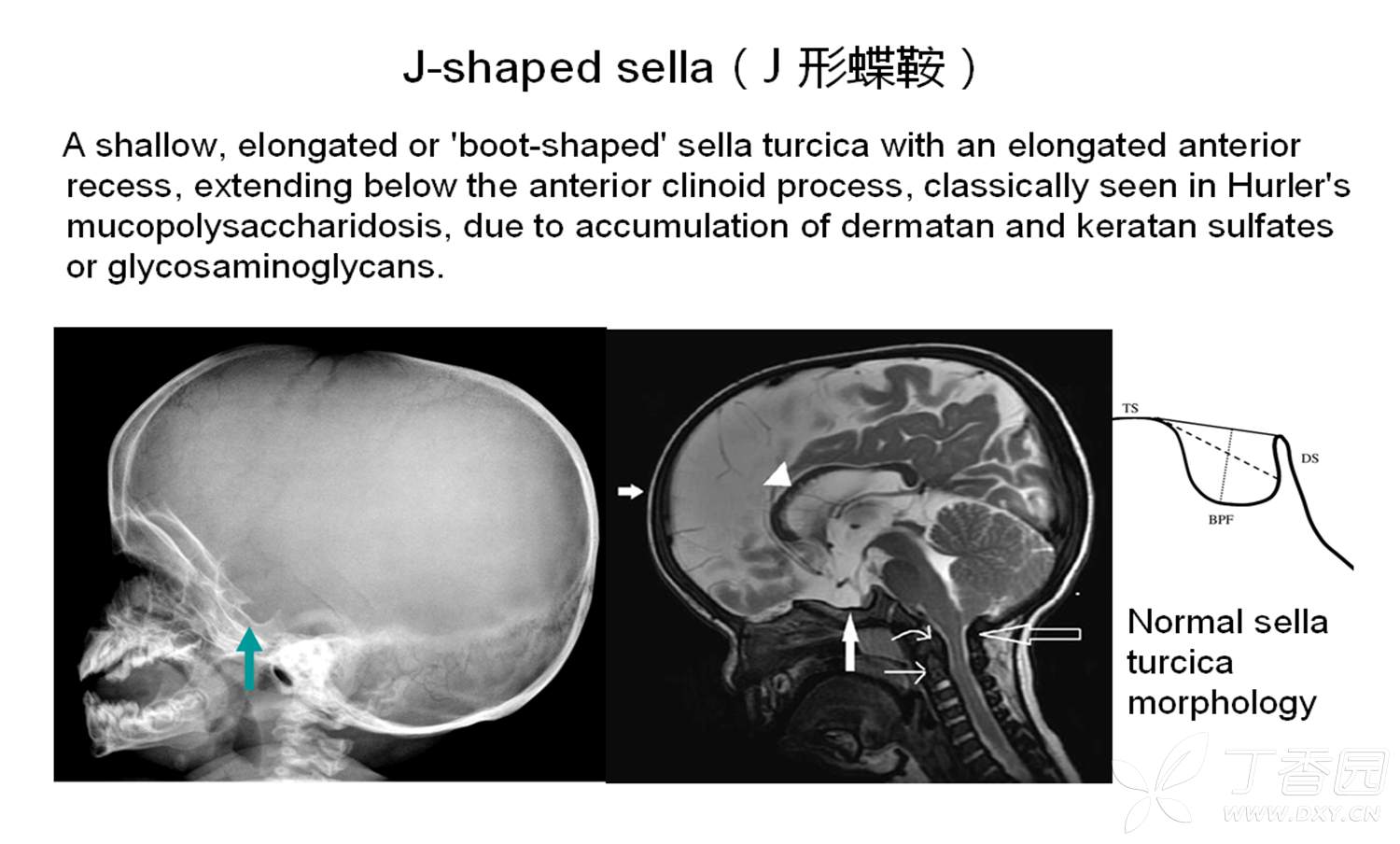 丁香园 - 医学交流社区，分享临床经验、病例讨论、考试科研、求职晋升经验