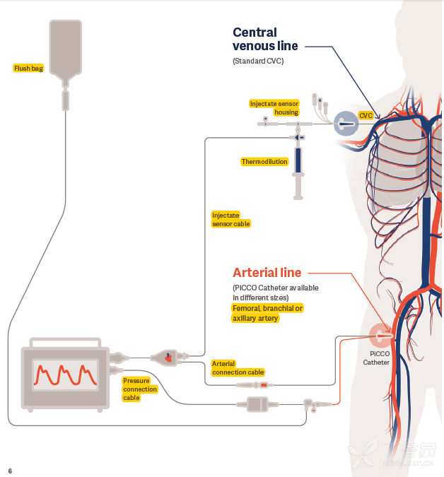 PICCO - 急救与危重病讨论版 -丁香园论坛