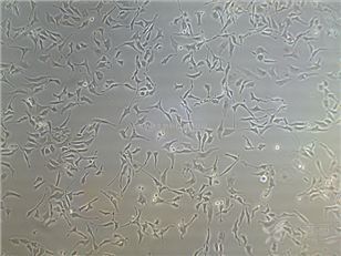 请问这两种都是HepG2细胞，为什么形态差异这么大呢 - 细胞生物学和信号转导版 -丁香园论坛