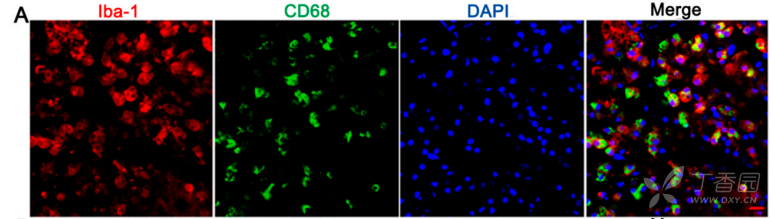 AD 中荧光染色，cd68、iba1、trem2的作用是什么，分别标记什么 - 神经生物学讨论版 -丁香园论坛