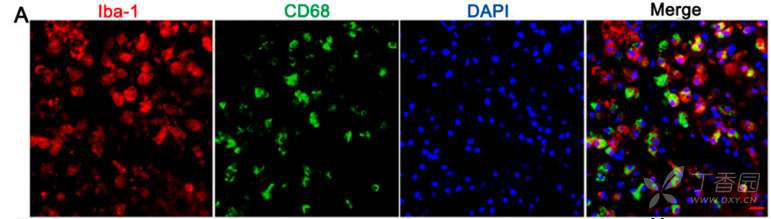 AD 中荧光染色，cd68、iba1、trem2的作用是什么，分别标记什么 - 丁香园论坛