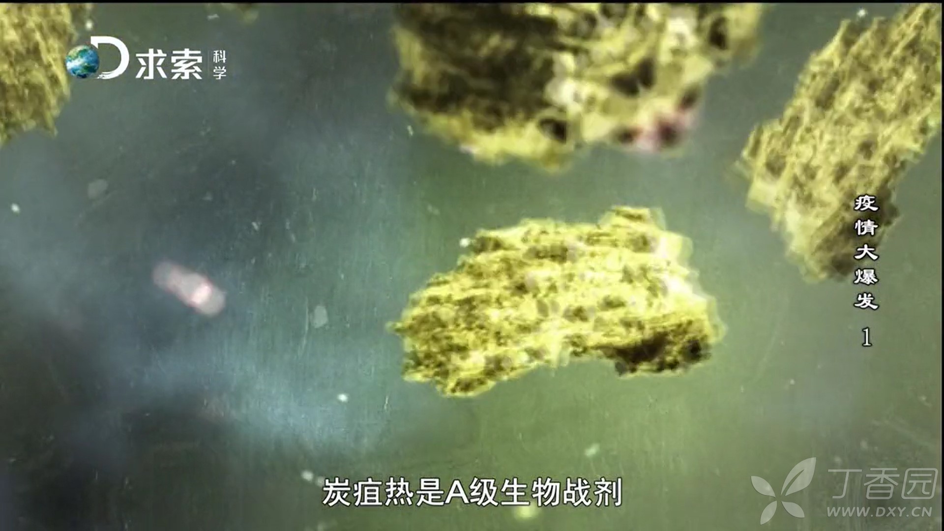 禾急RXID 的个人主页 - 丁香园 - 医学交流社区，分享临床经验、病例讨论、考试科研、求职晋升经验