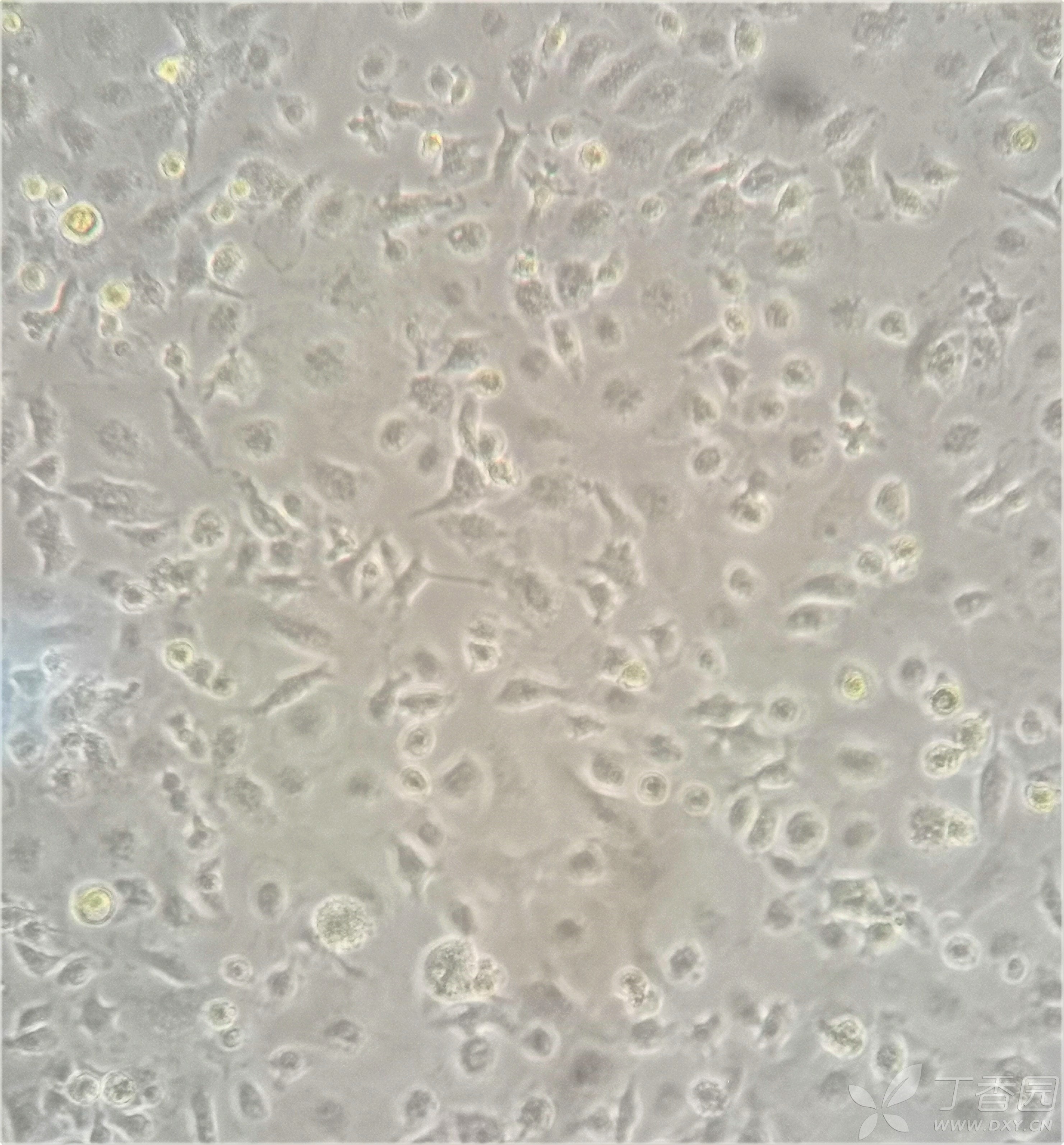 原代骨髓巨噬细胞BMDM 第7天镜下图 - 生理生化与组织胚胎 -丁香园论坛