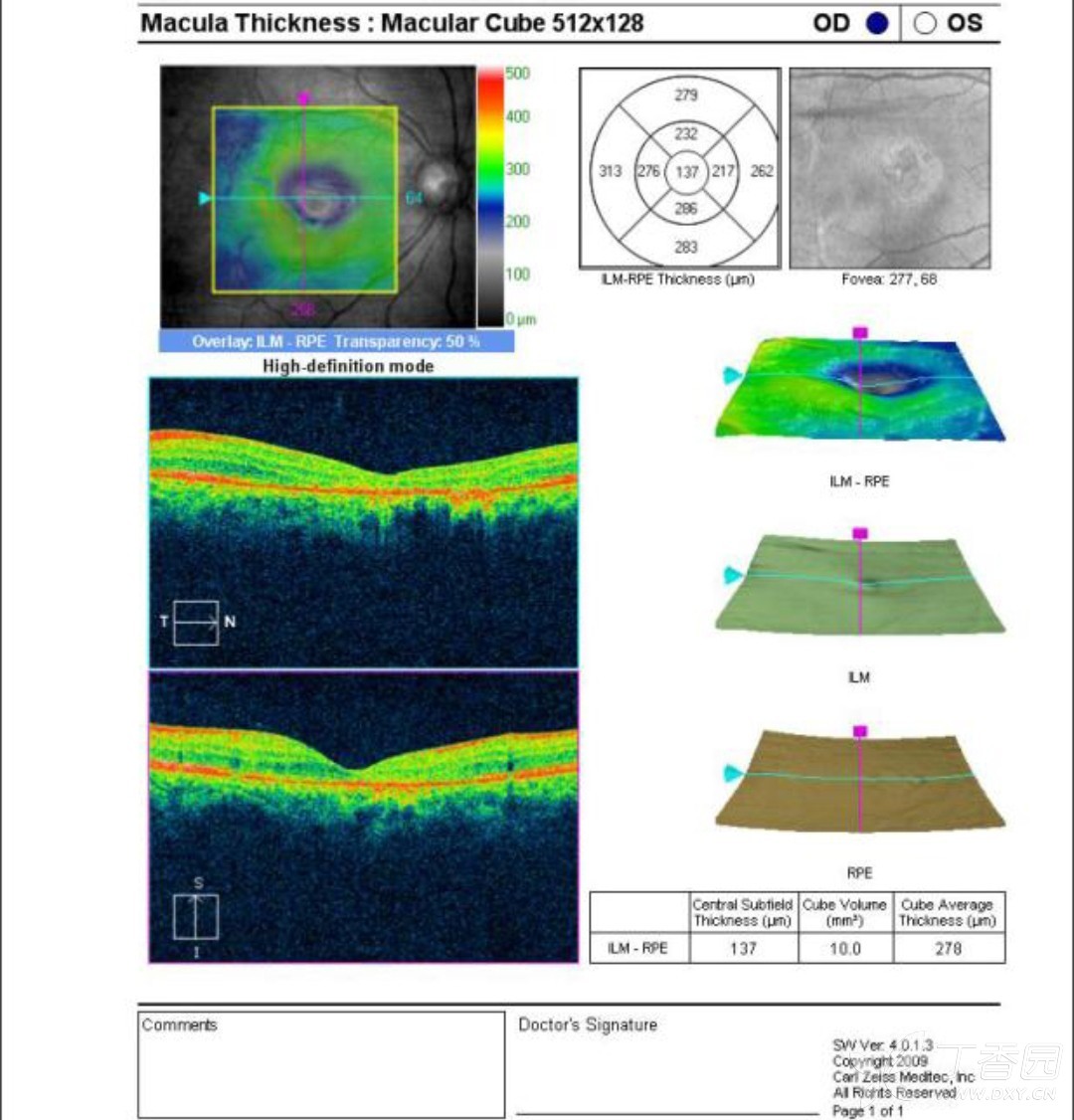 oct正常眼报告图片,ot图片,正常眼底图ot_大山谷图库