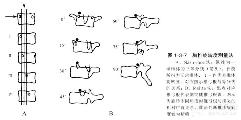 学习笔记-脊柱骨盆影像学参数 - 丁香园新站友成长版 -丁香园论坛