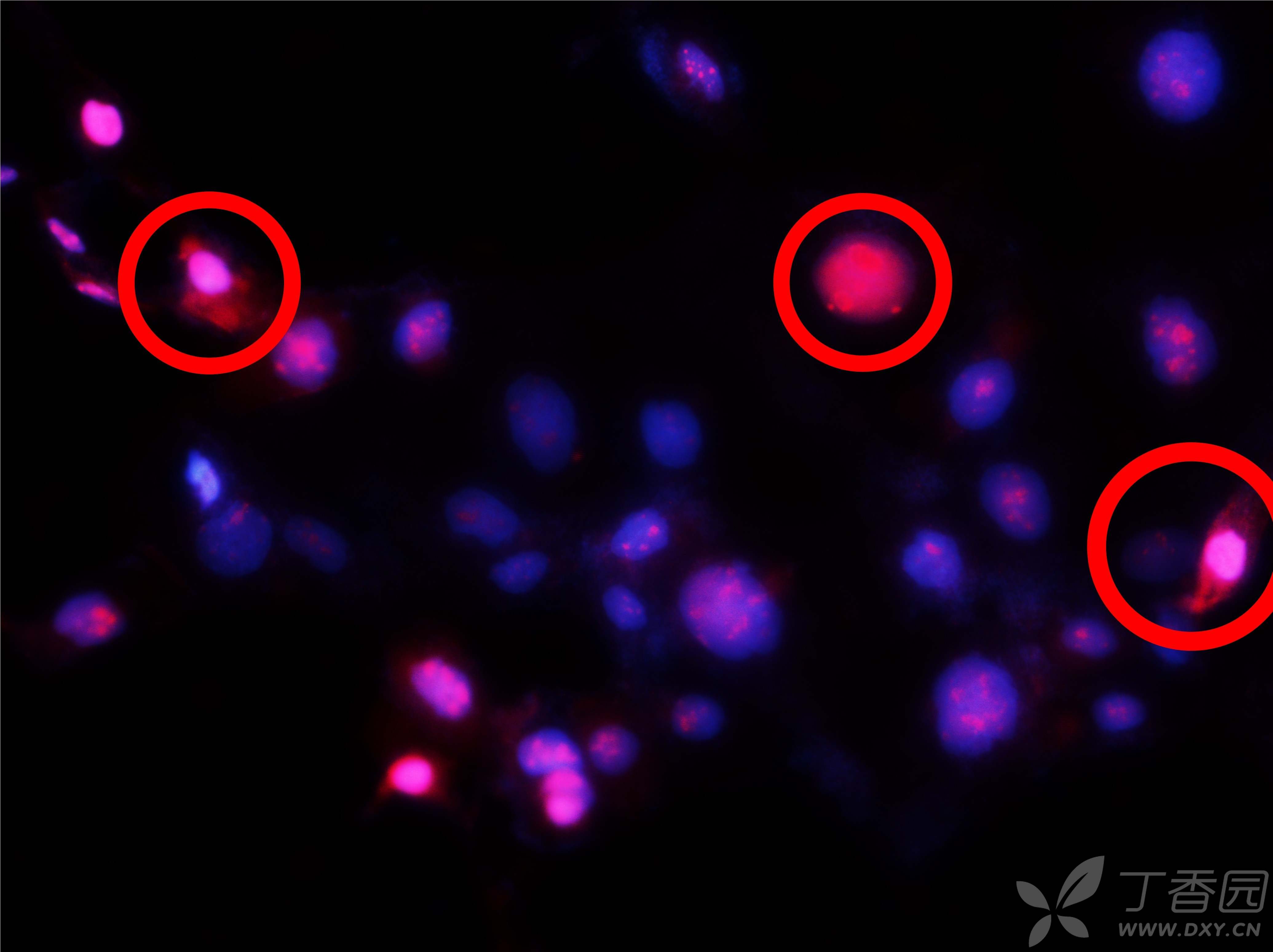 细胞线粒体mitoSOX检测求助 - 丁香园论坛