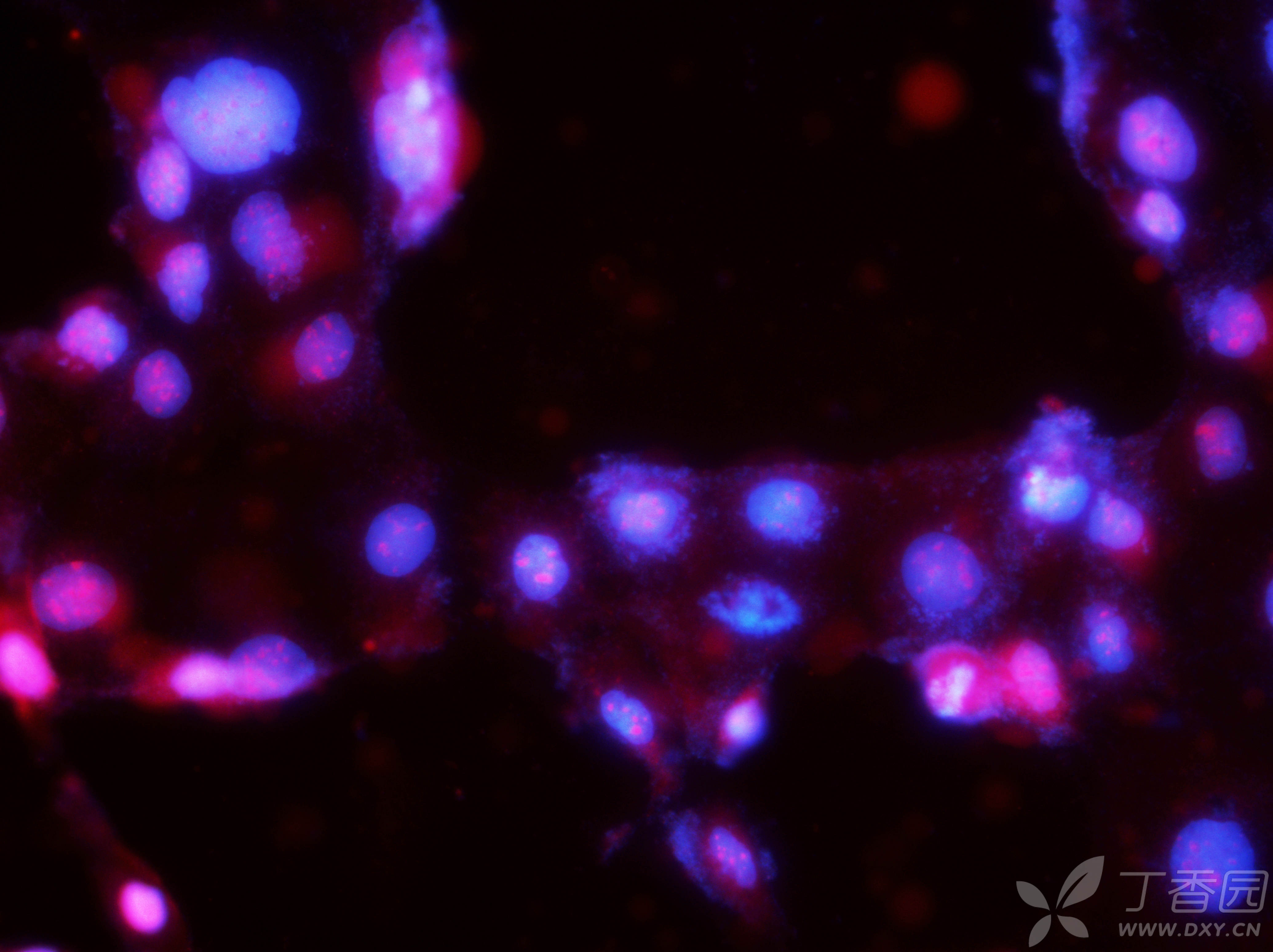 细胞线粒体mitoSOX检测求助 - 丁香园论坛