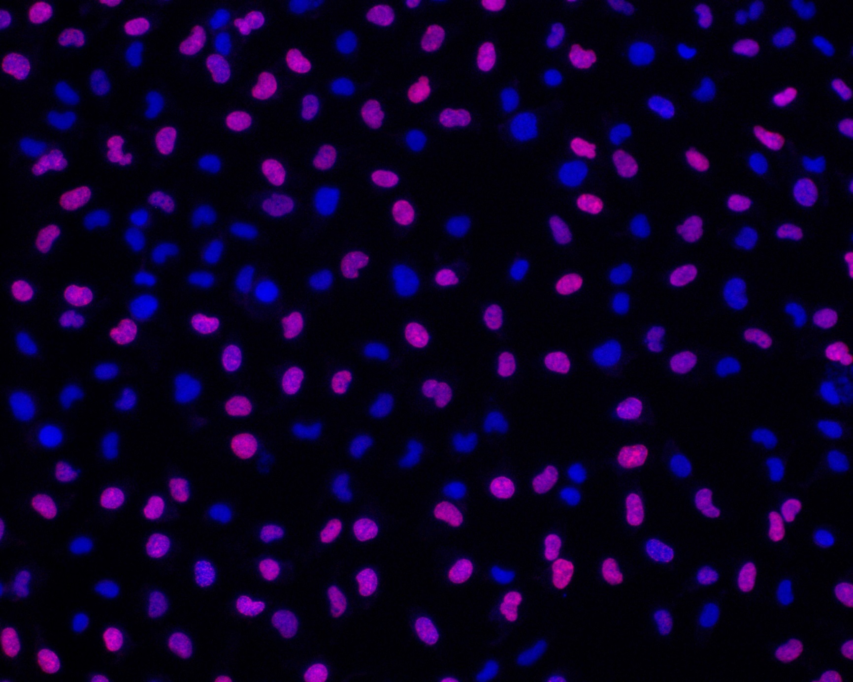 EdU细胞增殖检测试剂盒 - 企业动态 - 丁香通
