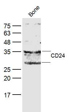 CD24抗体价格,详情介绍-960化工网 – 960化工网