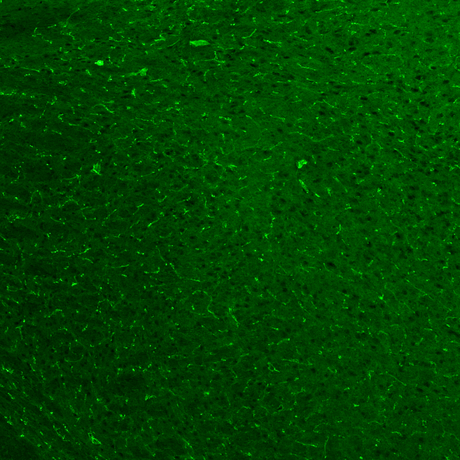 C57脑冰冻切片IBA1染色形状为线条状 - 丁香园论坛