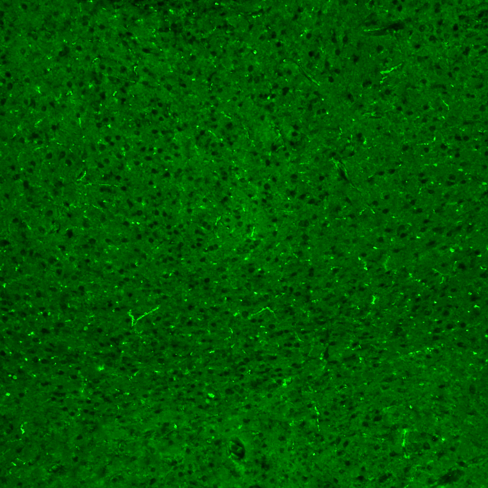 C57脑冰冻切片IBA1染色形状为线条状 - 丁香园论坛