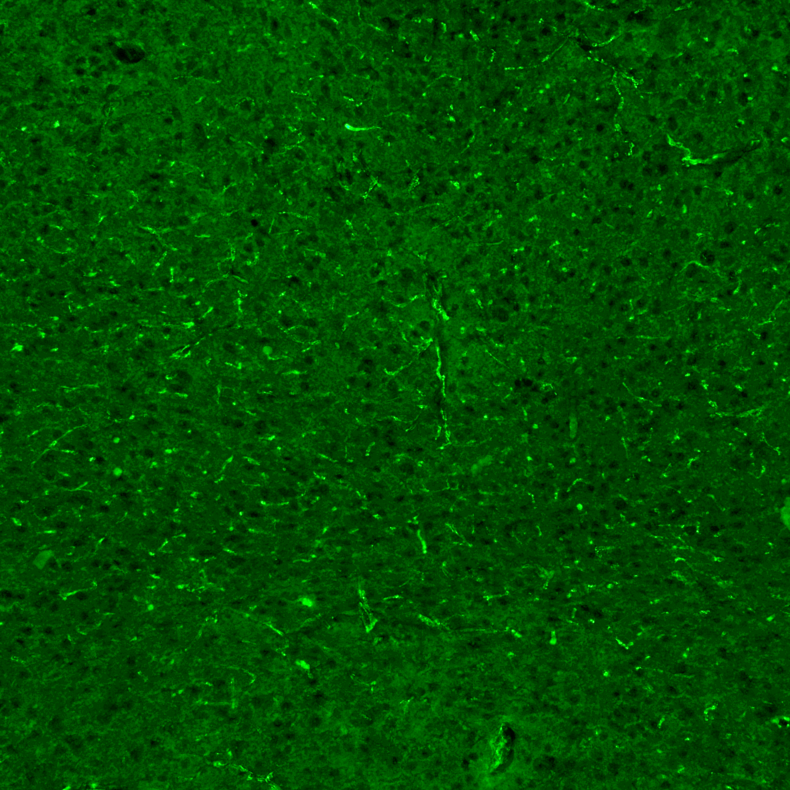 C57脑冰冻切片IBA1染色形状为线条状 - 丁香园论坛