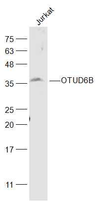 OTUD6B蛋白抗体价格,详情介绍-960化工网 – 960化工网