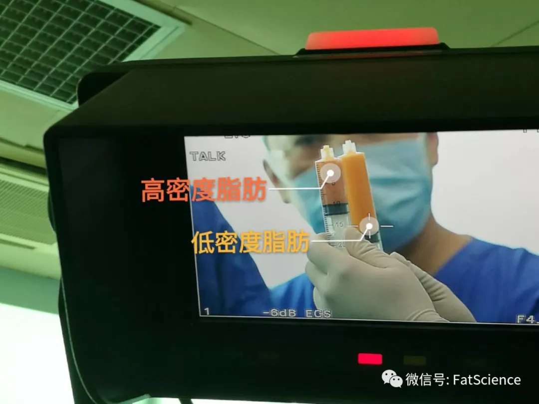 鲁峰谈脂肪