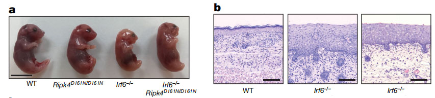 线性调控机制如何发现和研究？RIPK4-IRF6信号轴from Nature~ - 企业动态 - 丁香通