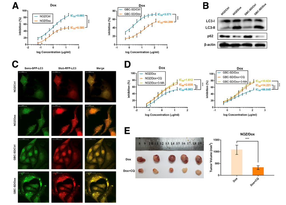 胆囊癌不再可怕！《Molecular Cancer》报道胆囊癌细胞耐药机制 - 自主发布 - 资讯 - 生物在线