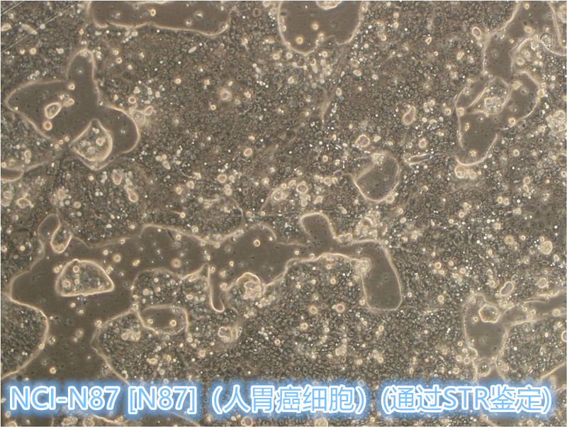 NCI-N87 [N87]细胞 (人胃癌细胞) (STR鉴定正确)价格_品牌:Procell-丁香通官网