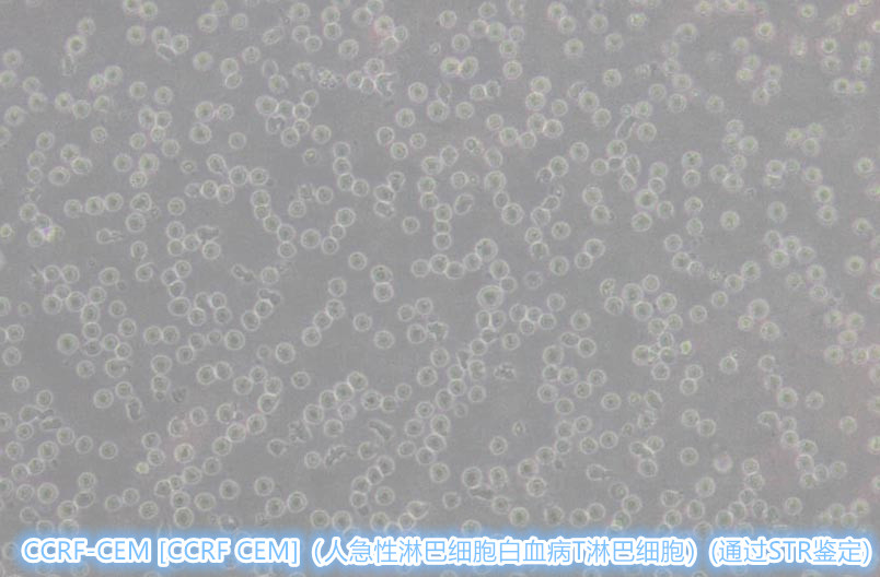 CCRF-CEM [CCRF CEM]人急性淋巴细胞白血病T淋巴细胞价格,详情介绍-960化工网 – 960化工网