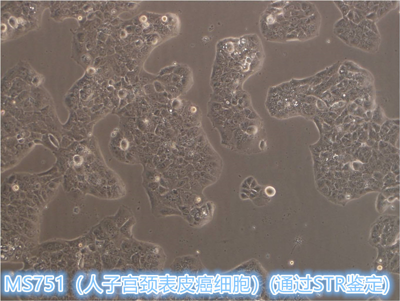 MS751 / MS751细胞 / MS751人子宫颈表皮癌细胞价格,详情介绍-960化工网 – 960化工网