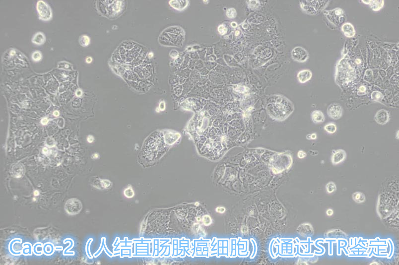 Caco-2 / Caco-2细胞 / Caco-2人结直肠腺癌细胞价格,详情介绍-960化工网 – 960化工网