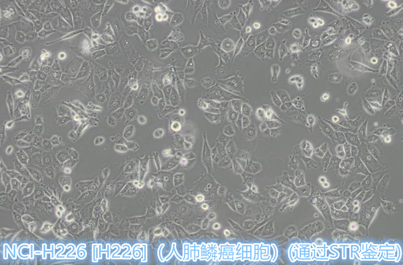 NCI-H226 [H226]细胞 / NCI-H226 [H226]人肺鳞癌细胞价格,详情介绍-960化工网 – 960化工网