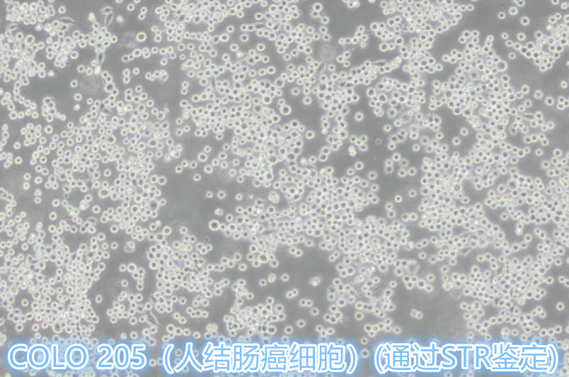 COLO 205 / COLO 205细胞 / COLO 205人结肠癌细胞价格,详情介绍-960化工网 – 960化工网