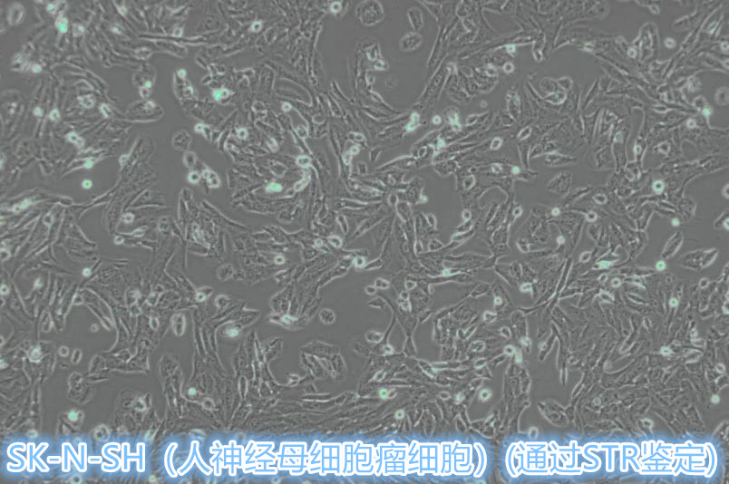 SK-N-SH / SK-N-SH细胞 / SK-N-SH人神经母细胞瘤细胞价格,详情介绍-960化工网 – 960化工网