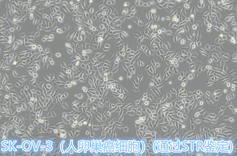 SK-OV-3 / SK-OV-3细胞 / SK-OV-3人卵巢癌细胞价格,详情介绍-960化工网 – 960化工网