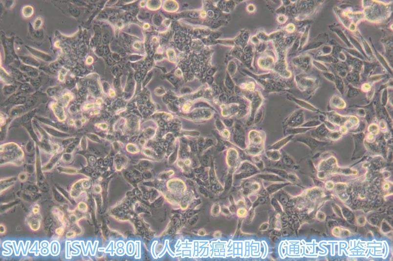 SW480 [SW-480]细胞 / SW480 [SW-480]人结肠癌细胞价格,详情介绍-960化工网 – 960化工网