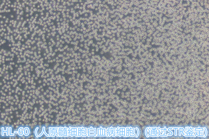 HL-60 / HL-60细胞 / HL-60人原髓细胞白血病细胞价格,详情介绍-960化工网 – 960化工网