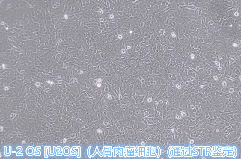 U-2 OS [U2OS]细胞 (人骨肉瘤细胞) (STR鉴定正确)价格_品牌:Procell-丁香通官网