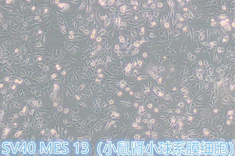 SV40 MES 13细胞 / SV40 MES 13小鼠肾小球系膜细胞价格,详情介绍-960化工网 – 960化工网
