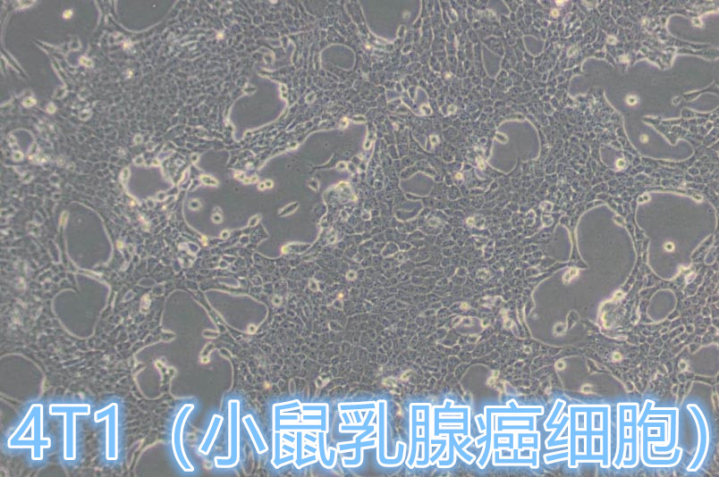 4T1 / 4T1细胞 / 4T1小鼠乳腺癌细胞价格,详情介绍-960化工网 – 960化工网
