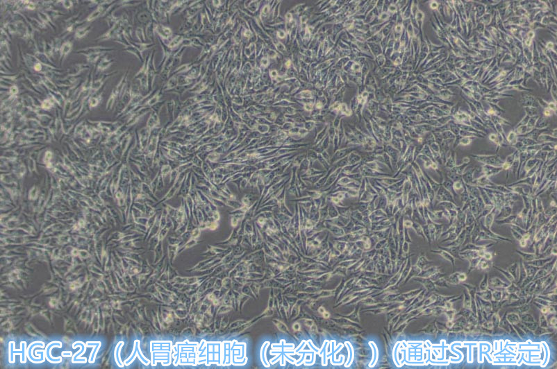 HGC-27 / HGC-27细胞 / HGC-27人胃癌细胞（未分化）价格,详情介绍-960化工网 – 960化工网
