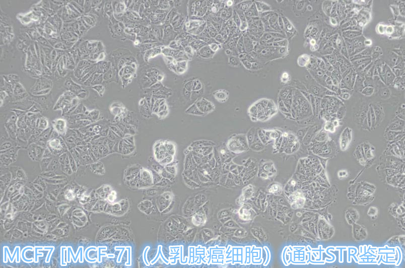 MCF7 [MCF-7]细胞 / MCF7 [MCF-7]人乳腺癌细胞价格,详情介绍-960化工网 – 960化工网