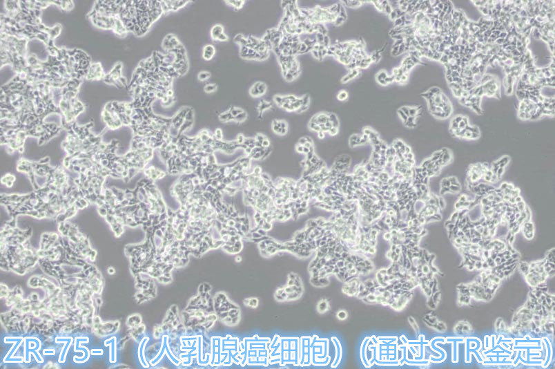 ZR-75-1细胞 (人乳腺癌细胞) (STR鉴定正确)价格_品牌:Procell-丁香通官网